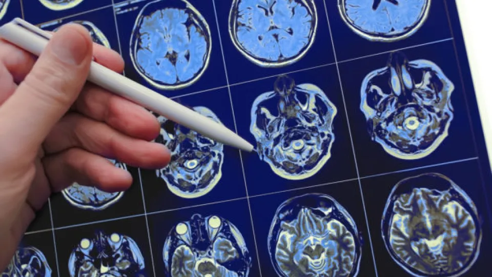 What does a neurodiagnostic technologist do? | Concorde Career Colleges